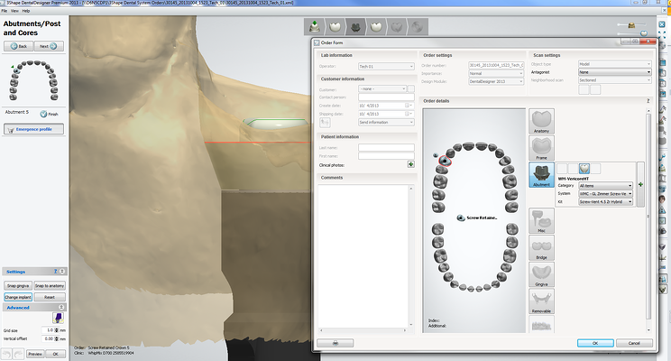 2013 Dental System from 3Shape: What's New