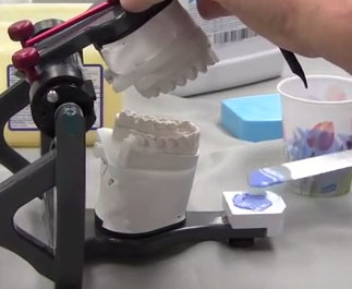 How to Make a Custom Anterior Guide Table