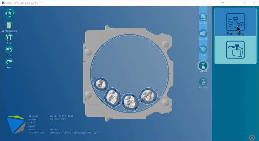 Introducing MillBox – A new powerful CAM Interface powered by SUM3D Dental