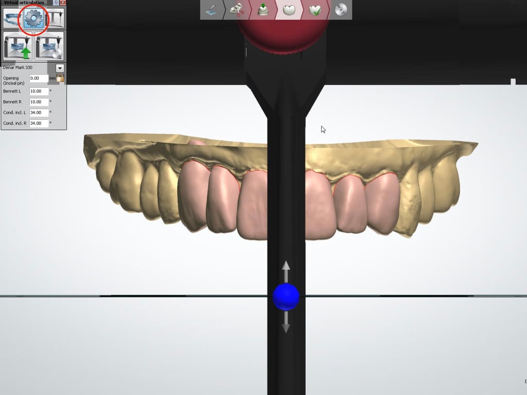 Digital Smile Design Essentials: What You See is Not Necessarily What ...