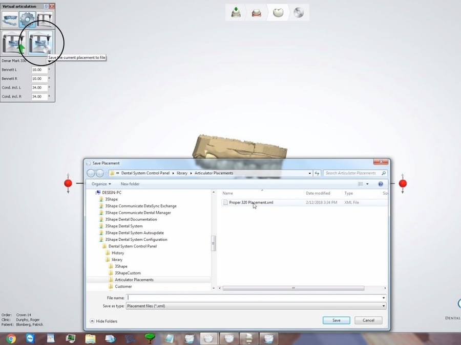 Proper Setup of the 3Shape Virtual Articulator with Full Arch Mounted ...