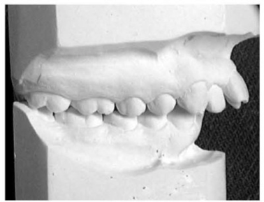 Functional Occlusion in the Dental Lab: Understanding the 3 Classes of ...